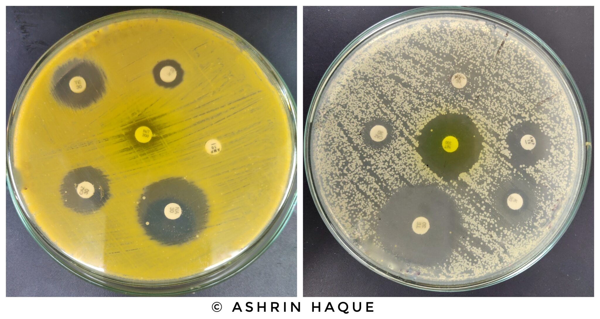 Thiomargarita magnifica - The Giant of the Microbial World - Learn Life ...