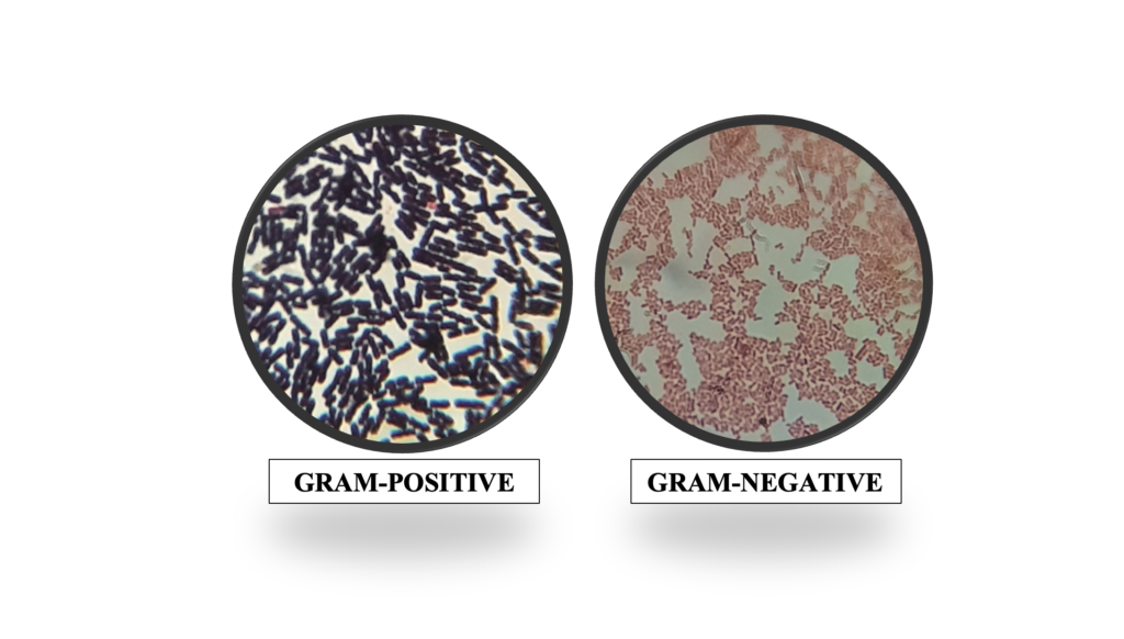 GRAM STAINING: GRAM-POSITIVE VS GRAM-NEGATIVE BACTERIA - Learn Life Science
